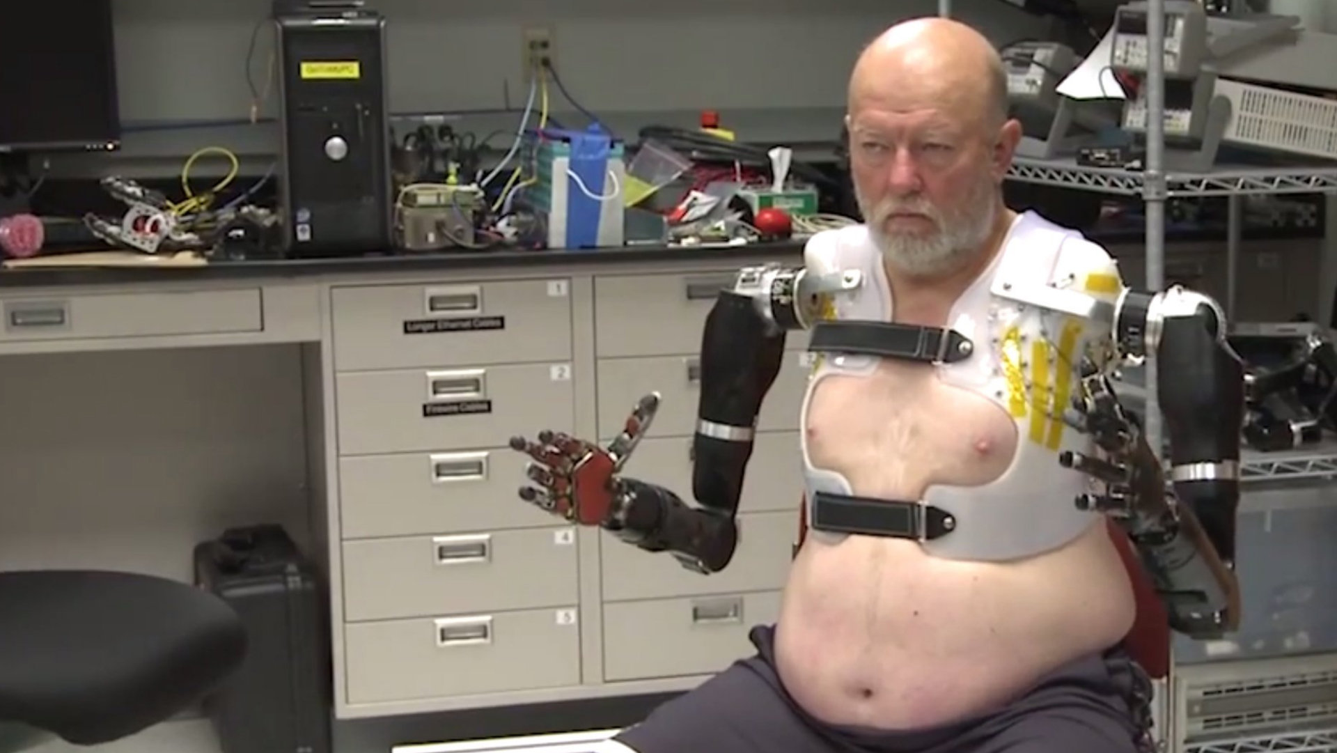 A taste of the future: Double amputee controls two bionic arms at the ...